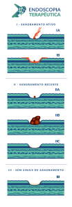 Classificação de Forrest • Endoscopia Terapeutica