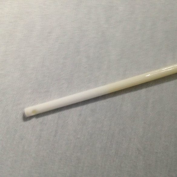 Corpo estranho gástrico - Palito de pirulito • Endoscopia Terapeutica